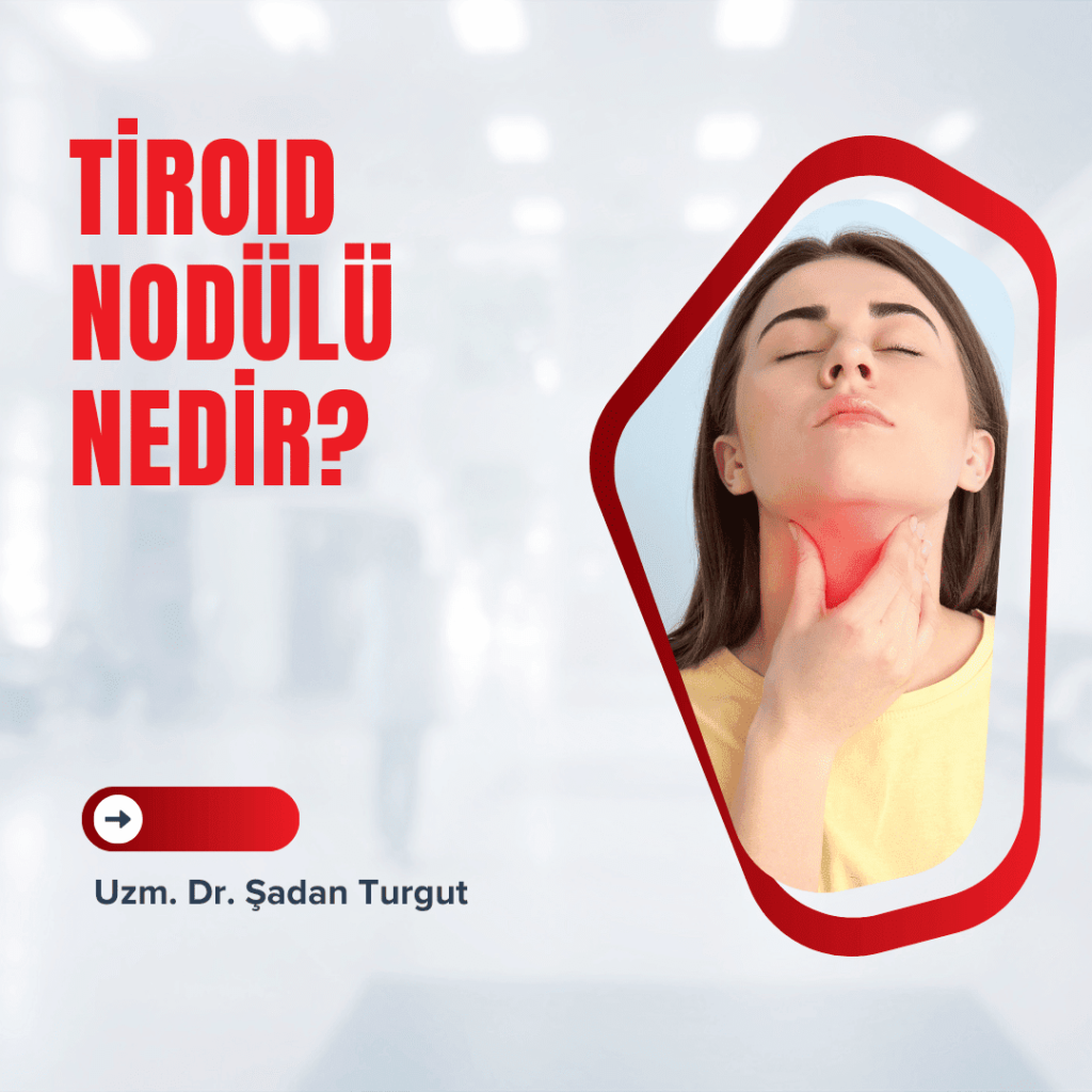 Tiroid nodülü nedir? – Uzm. Dr. Şadan Turgut